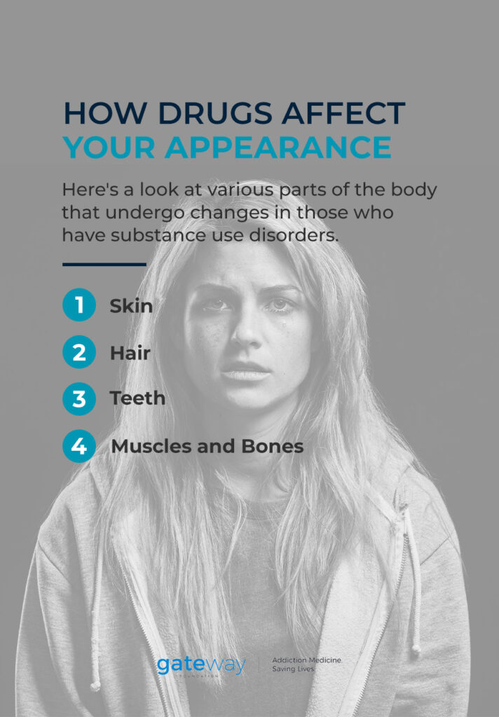 Effects of Substance Use on Your Appearance